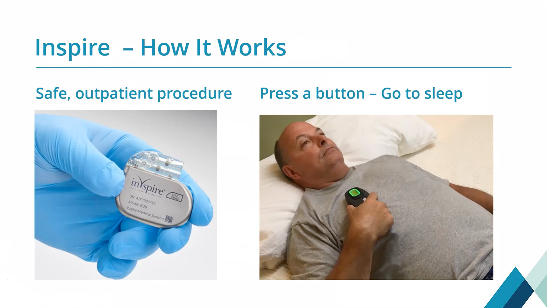 Inspire Sleep Apnea Solution Health Talk With Sleep Disorder Center